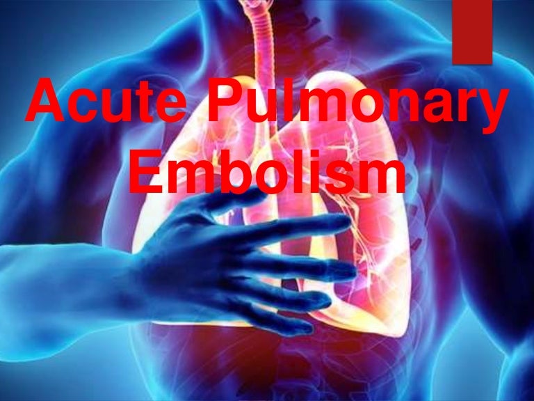 Acute Pulmonary Embolism: Introduction, Clinical presentation, Classi…