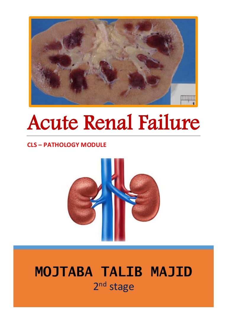 Acute Renal Failure 2018 acute-renal-failure-2018