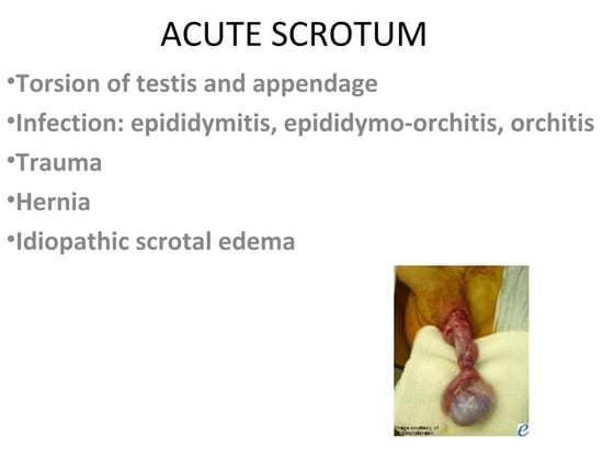 Scrotal swelling | PPT