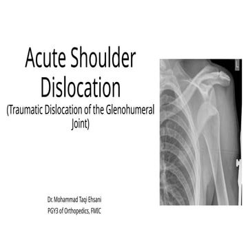 Acute Shoulder Dislocation (Traumatic Dislocation of the Glenohumeral Joint).pptx