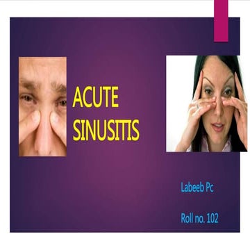 Acute sinusitis | PPTX