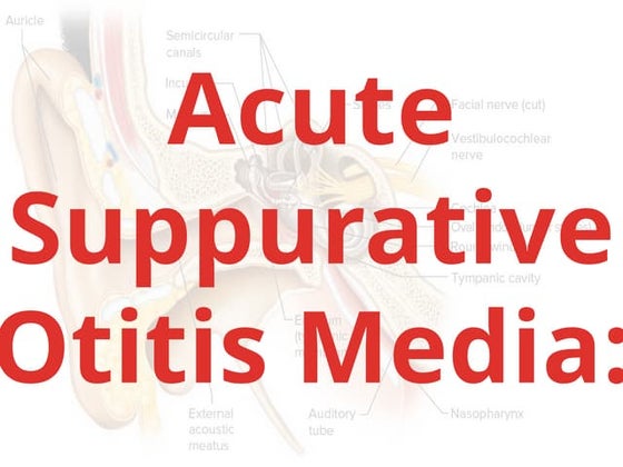 Acute Suppurative Otitis Media | PPTX