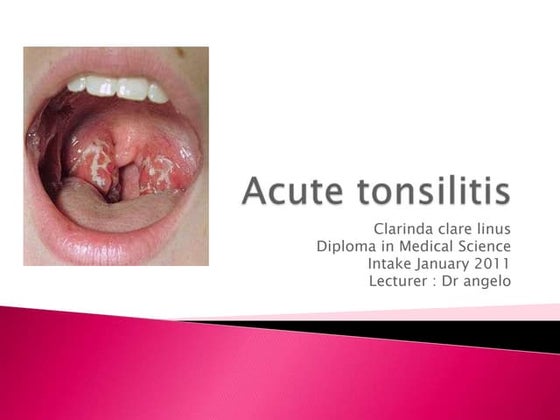 Anatomy and physiology tonsils | PPTX | Ear, Nose and Throat Conditions | Diseases and Conditions