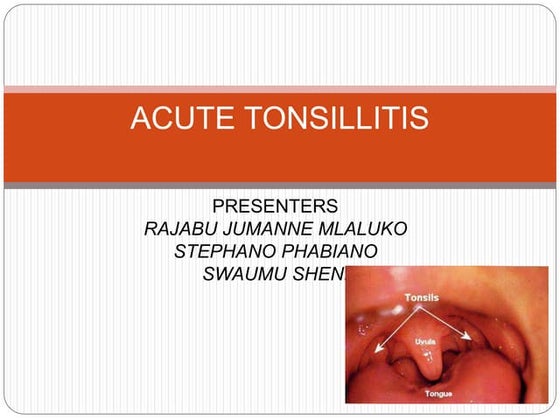 Acute tonsillitis and its several complications | PPT