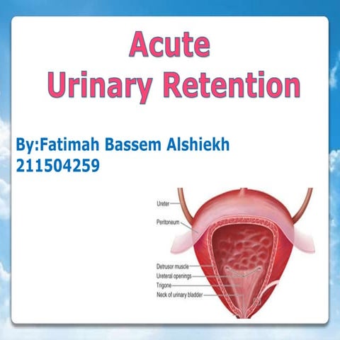 Acute urinary retintion | PPTX