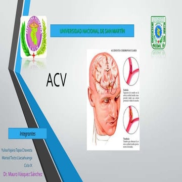 ACV | PPTX