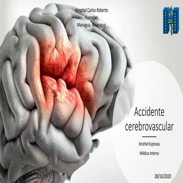 Accidente Cerebrovascular Pptx