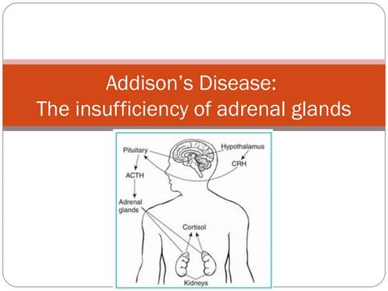 Addisons disease | PPTX | Hormonal Disorders | Endocrine and Metabolic ...