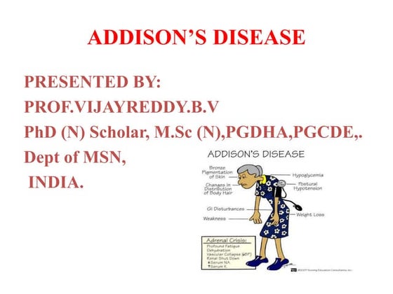 Addisons disease | PPTX | Hormonal Disorders | Endocrine and Metabolic ...