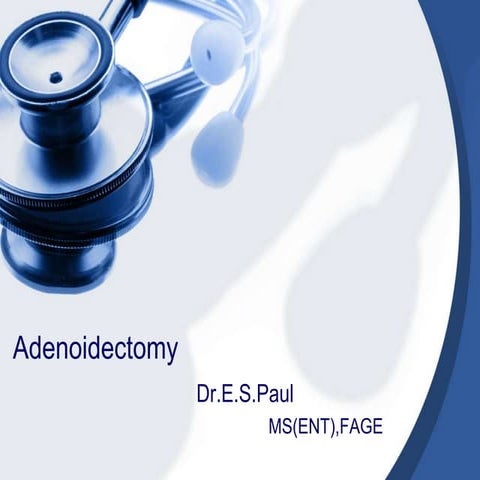 Adenoidectomy | PPTX