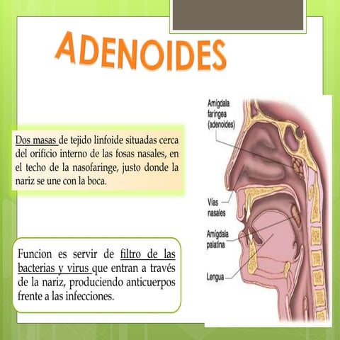 ADENOIDECTOMÍA AMIGDALECTOMÍA