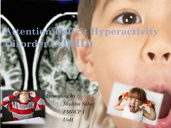 Best adhd treatment | PPTX | Brain and Nervous System Disorders | Diseases and Conditions