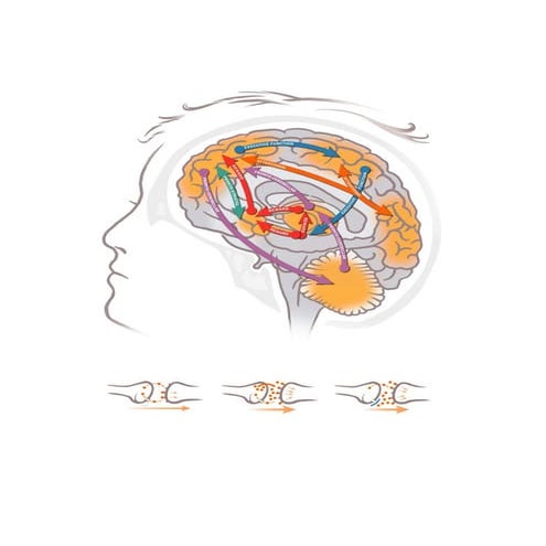 How ADHD effects the brain-A simple graphic | PDF