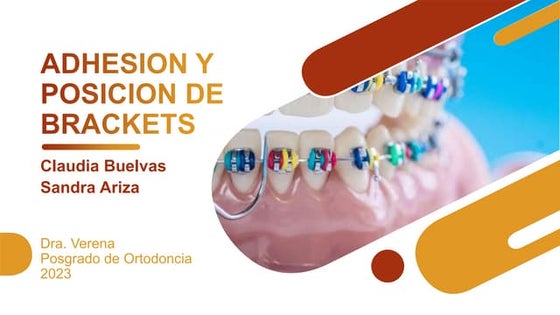 CEMENTACION DE BRACKETS.pptx