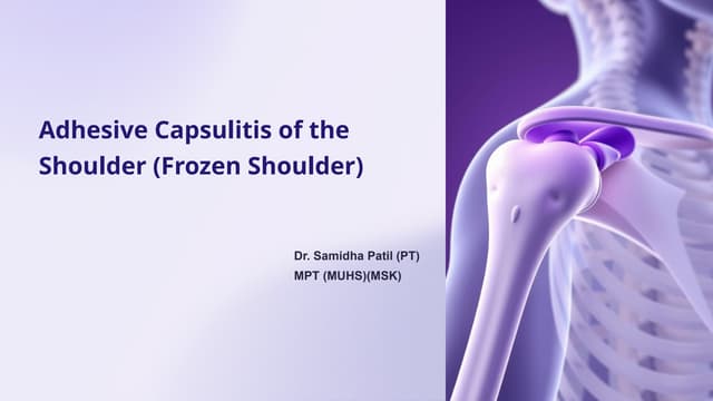 Frozen Shoulder Physiotherapy Management | PPTX