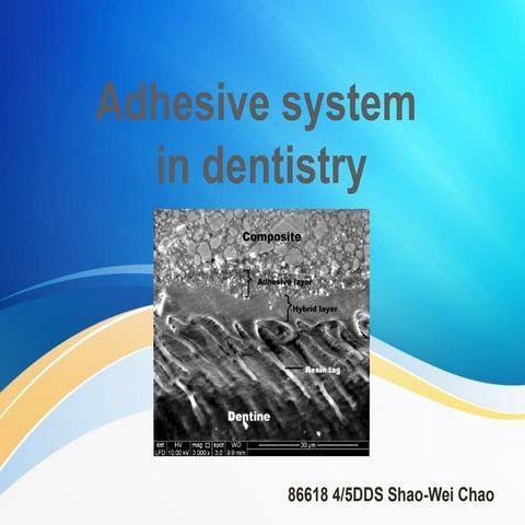 Adhesive system in dentistry, bachelor level | PPTX