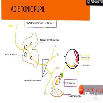 Adie Tonic Pupil 06 Nov 2022.pdf