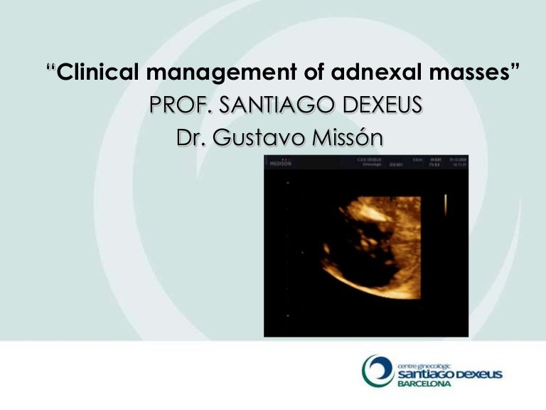 Adnexal Masses