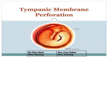 Tympanic membrane perforation seminar pdf.! | PDF