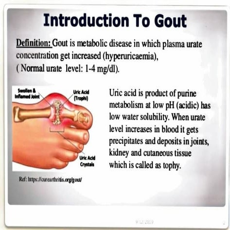 Gout and antigout drugs | PDF
