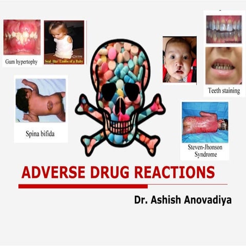 Adverse drug reactions and Pharmacovigilance-2 | PPTX