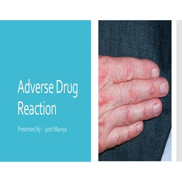 Adverse drug reactions | PPTX