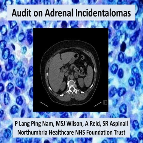 Overview of adrenal incidentaloma PPT- PPTX | PPTX