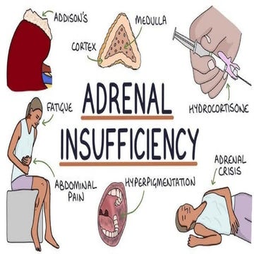 Adrenal insufficiency Surgery Presentati | PPTX
