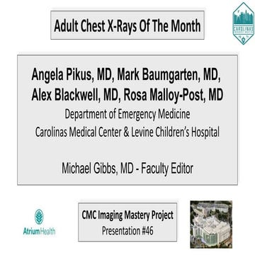 Adult Chest X-Rays Of The Month - #46 | PPTX