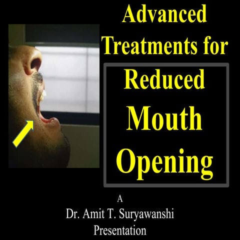 Advanced Treatments for Reduced Mouth Opening by Dr. Amit T ...