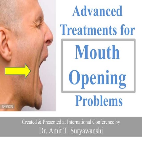 Mouth opening Problems ? Get advanced treatment (Treatment of OSMF) | PPTX