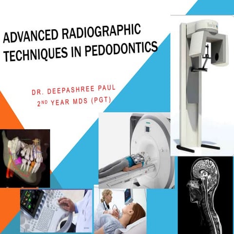 Advanced Radiographic Techniques In Pedodontics Pptx
