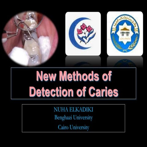 Advance method in detection of dental caries copy | PPT