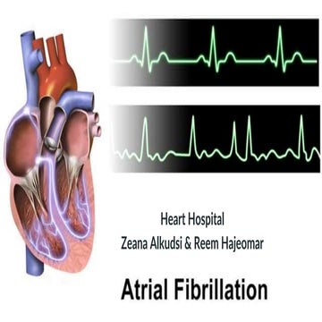 atrial fibrillation guidelines presentation | PPTX