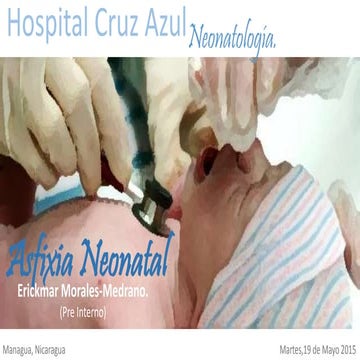 Asfixia neonatal | PPTX