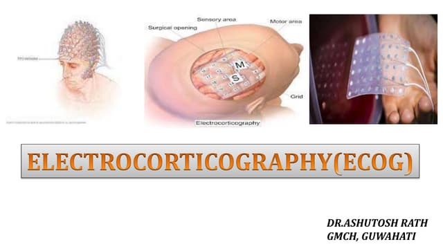 Electroretinogram (erg) | PPTX