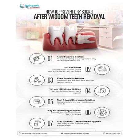 How to Prevent Dry Socket After Wisdom Teeth Removal | PDF