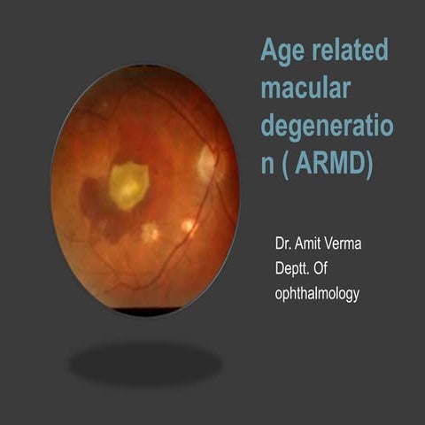 Age related macular degeneration ( | PPTX