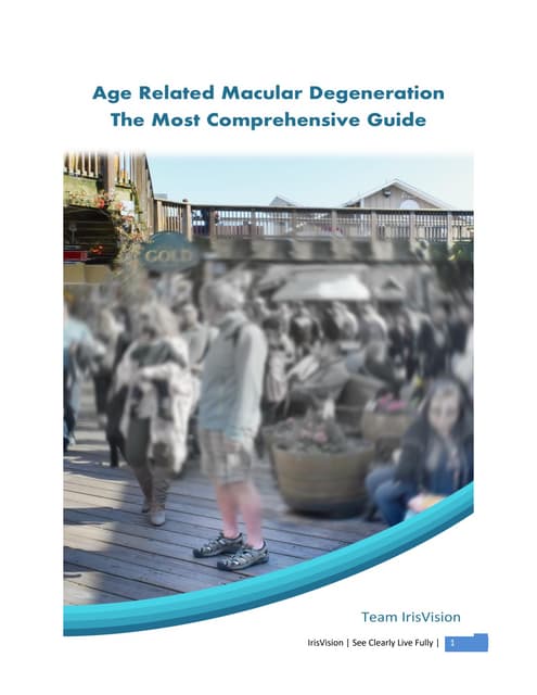 AGE - RELATED MACULAR DEGENERATION (AMD) | PDF