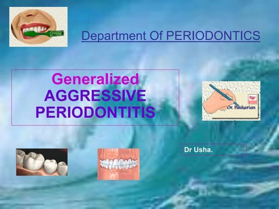 Aggressive Periodontal Disease.ppt