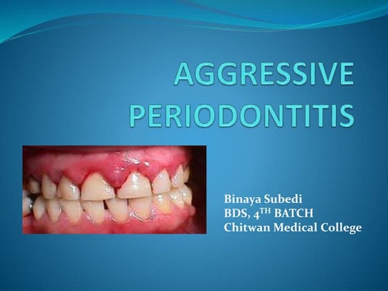 Epidemiology of periodontal diseases | PPT