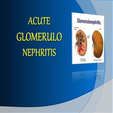 acute glomerulo nephritis | PPTX