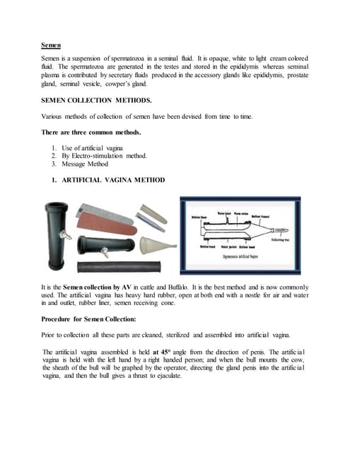 Artificial insemination | PPTX | Infertility | Reproductive Health