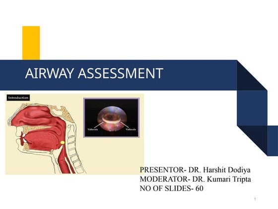 Difficult airway | PPT
