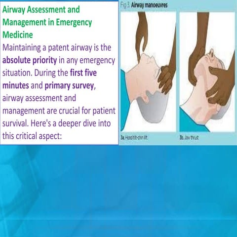 Airway Assessment and Management in emergency medicinent, .pdf