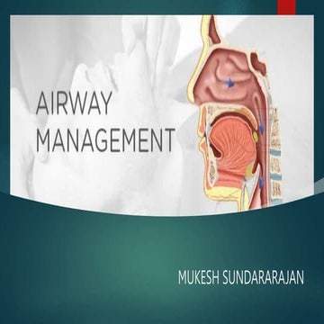 airway management.pptx