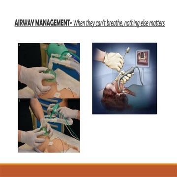 airway management in Anesthesia for intubation | PPTX