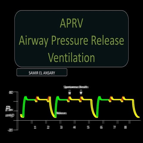 Airway releasing ventilation | PPTX