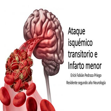 AIT Ataque isquémico Transitorio Neurología | PPTX