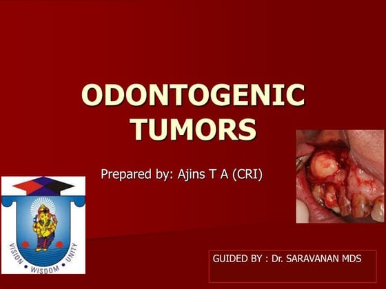 calcifying epithelial odontogenic tumor Ceot | PPTX